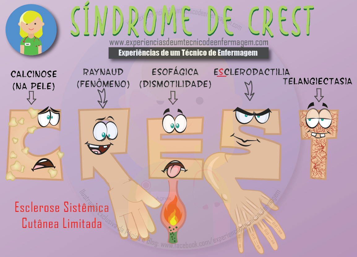 Síndrome de Crest - Enfermagem Ilustrada