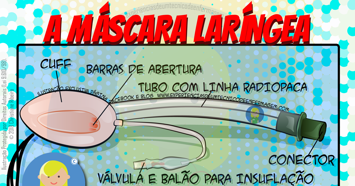 A Máscara Laríngea (ML) - Enfermagem Ilustrada