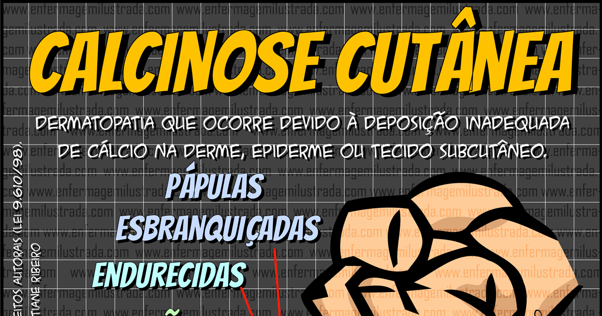 Calcinose Cutânea | Enfermagem Ilustrada