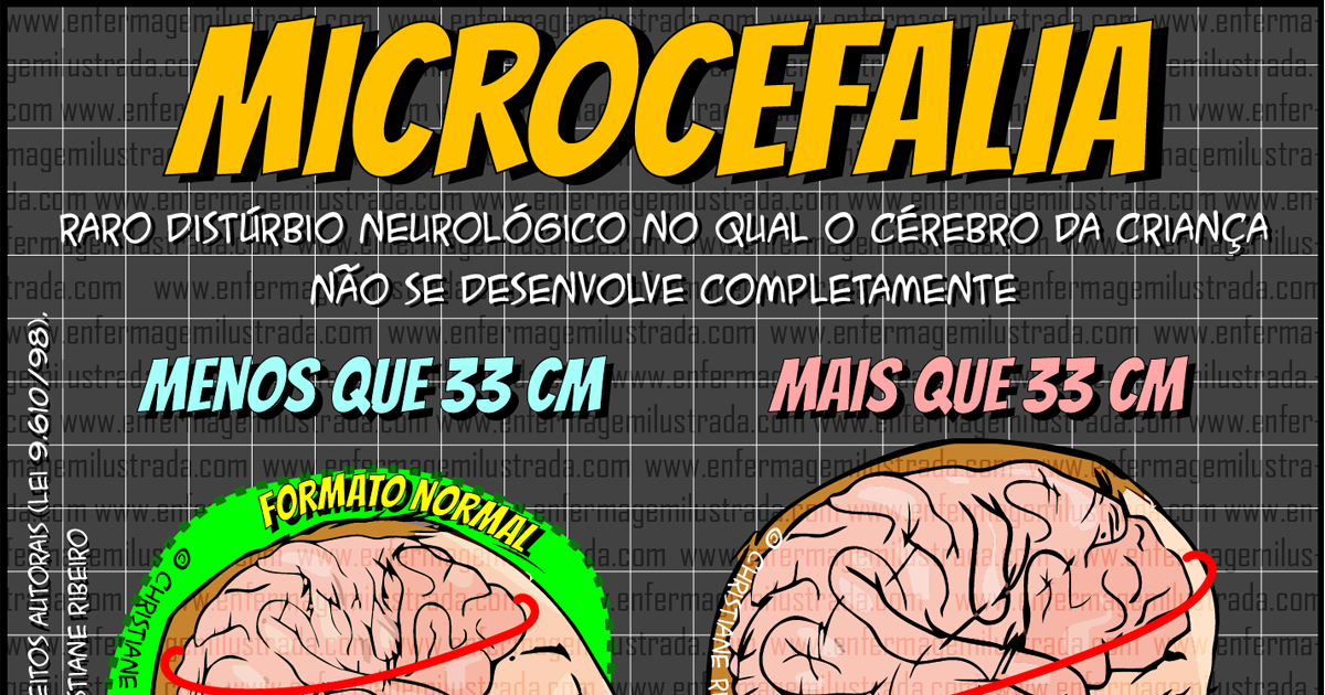 Microcefalia - Enfermagem Ilustrada