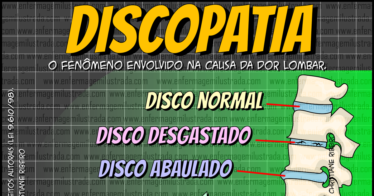 A Discopatia e seus tipos - Enfermagem Ilustrada