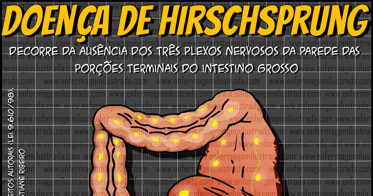 Doença de Hirschsprung - Enfermagem Ilustrada