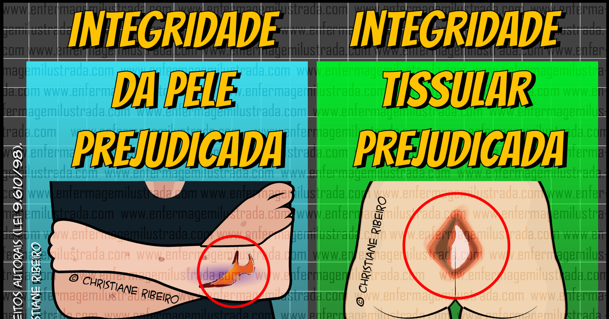Integridade da Pele Vs. Integridade Tissular - Enfermagem Ilustrada