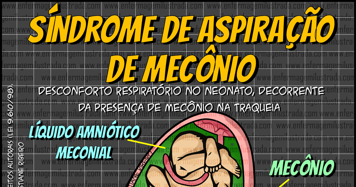 Síndrome de Aspiração de Mecônio (SAM) - Enfermagem Ilustrada