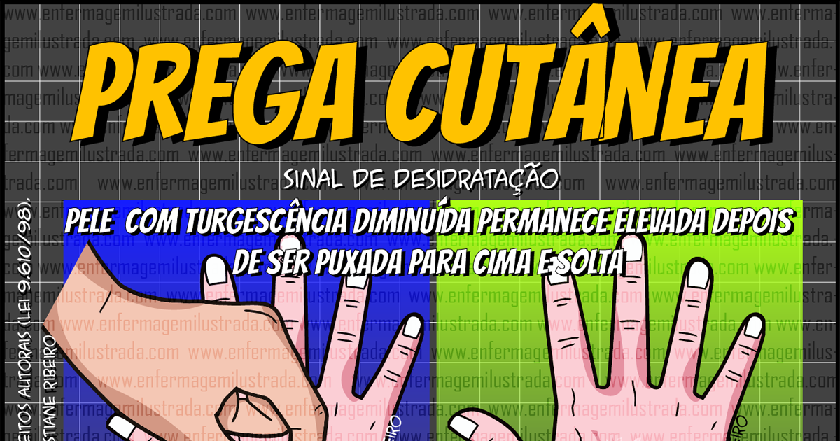 Sinal Da Prega Desidratação - RETOEDU