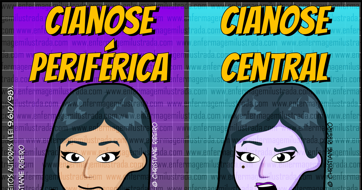 Cianose: Periférica e Central - Enfermagem Ilustrada