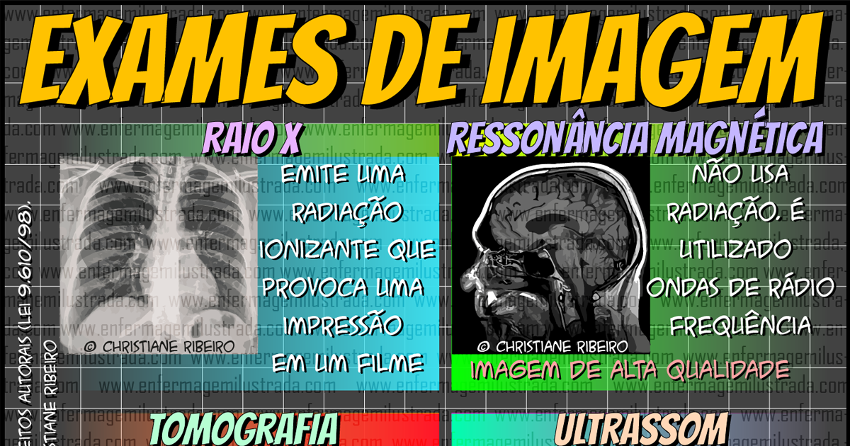 Os tipos de exame de imagens - Enfermagem Ilustrada