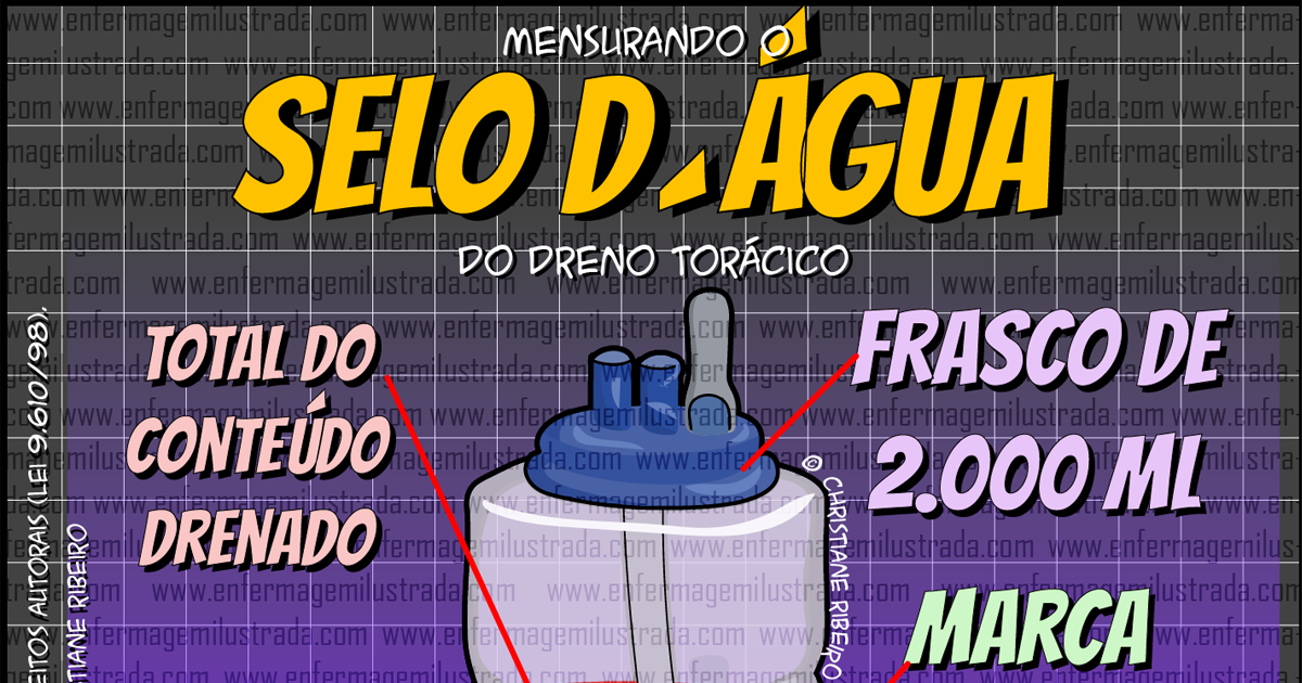 Capacidade do Selo d´água do dreno de tórax - Enfermagem Ilustrada
