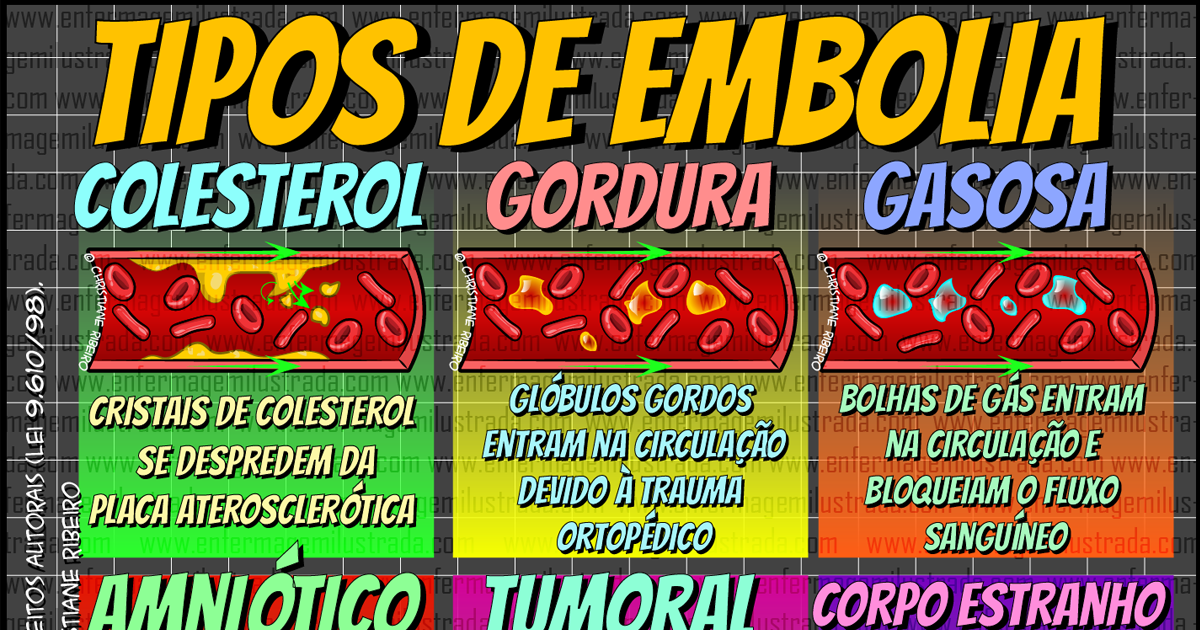 Os tipos de Embolia - Enfermagem Ilustrada