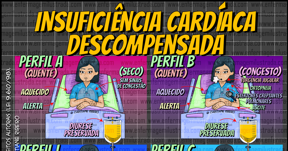 Insuficiência Cardíaca Descompensada e a Classificação de Stevenson ...