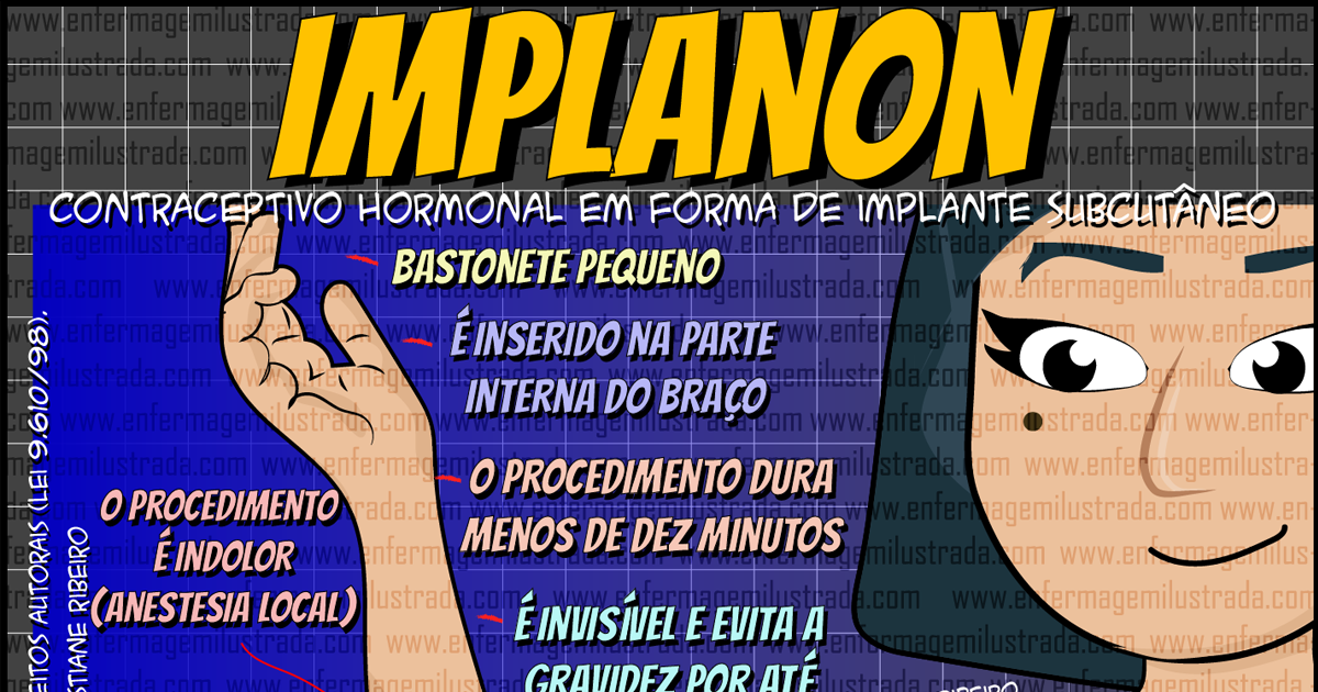 Implanon: Método Contraceptivo Subcutâneo - Enfermagem Ilustrada