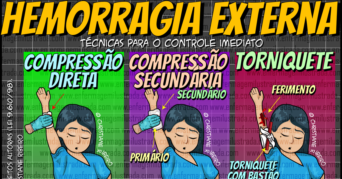 Controle de Hemorragia Externa - Enfermagem Ilustrada