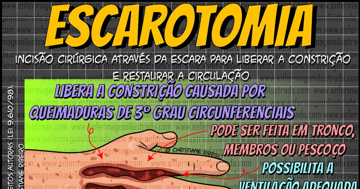 Escarotomia: O que é? - Enfermagem Ilustrada