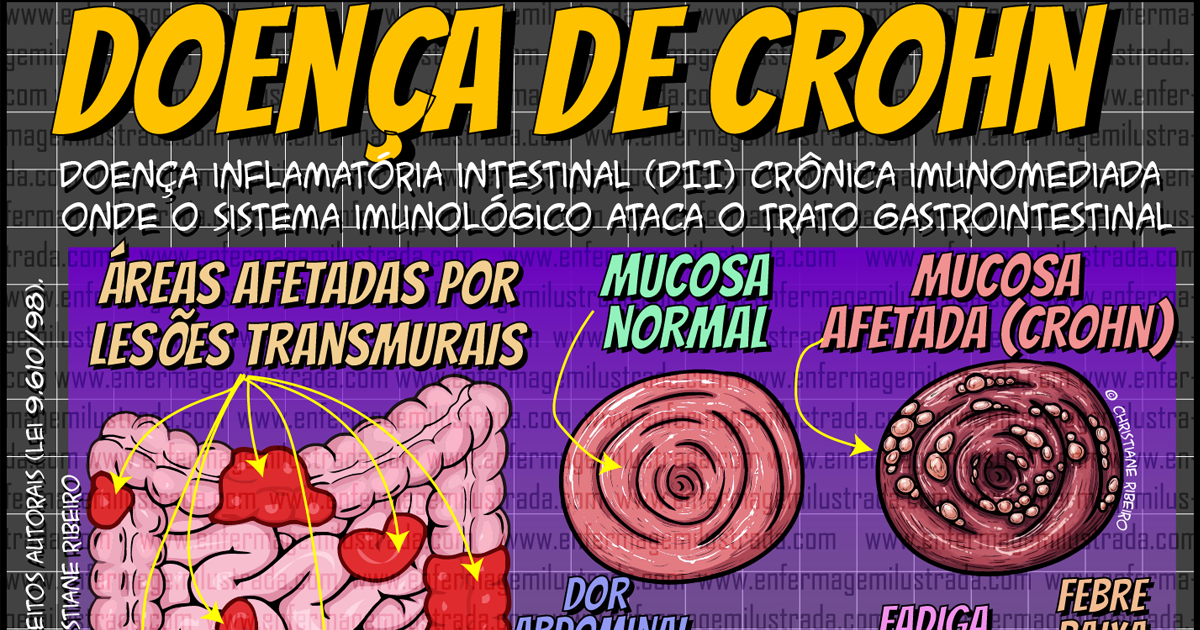 Doença de Crohn: Entendendo a Doença Inflamatória Intestinal ...