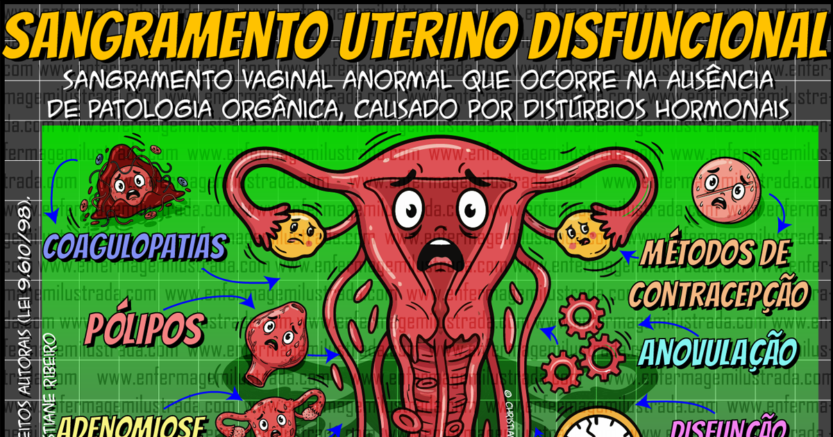 Sangramento Uterino Disfuncional (SUD) - Enfermagem Ilustrada